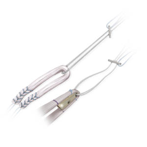 ACL TightRope – Biocells Surgical